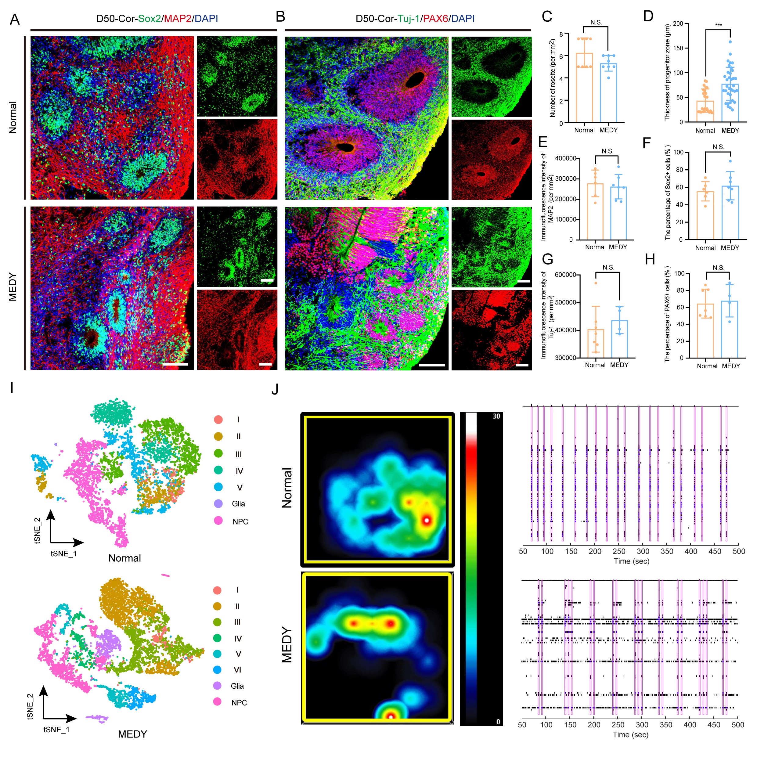 Cell Reports Methods| 邵志成团队开发了人多种神经类器官/脑组织冻存新技术-复旦大学脑科学转化研究院